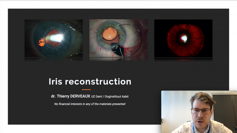 Presentatie irisreconstructie | dr. Derveaux UZ Gent